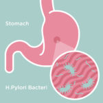 Easy At-Home H. Pylori Test - A Glimpse Into The Power Of Breath