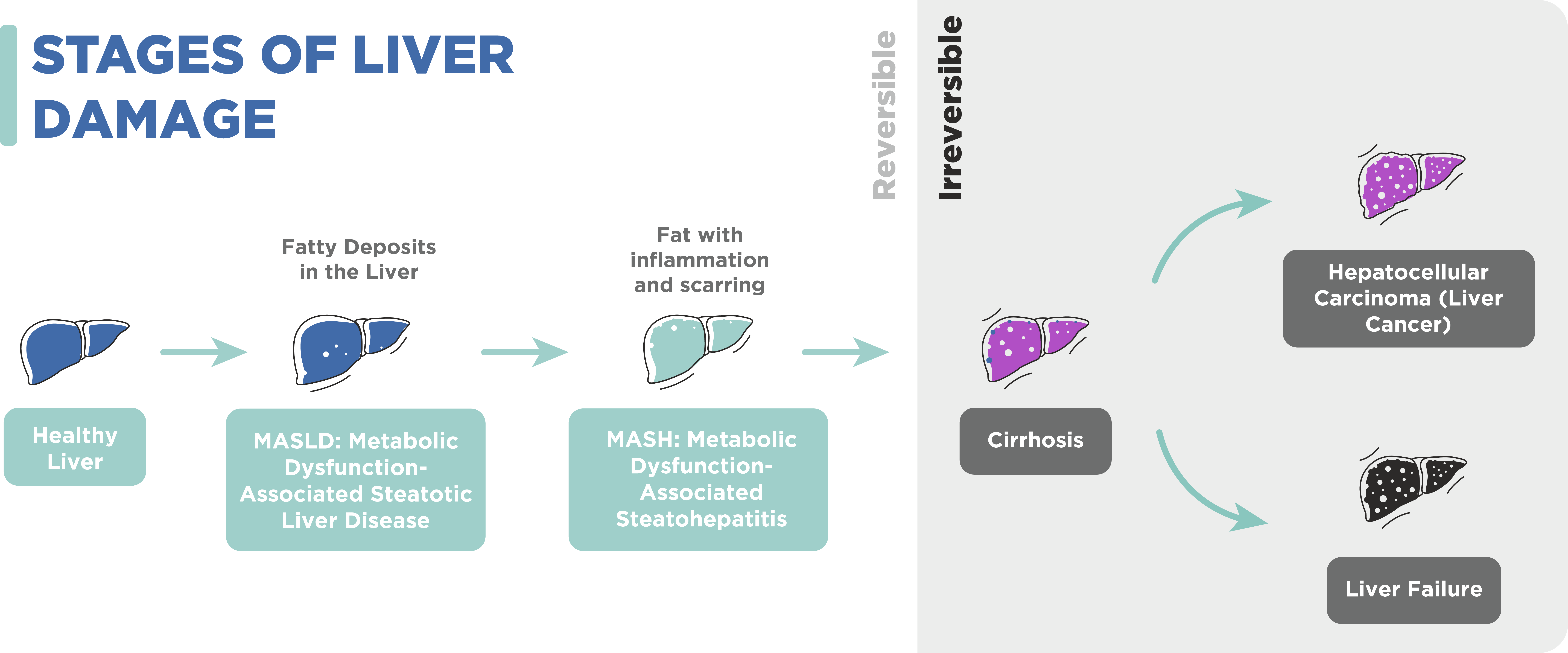 SIBO And Liver Disease: The Gut–Liver Connection